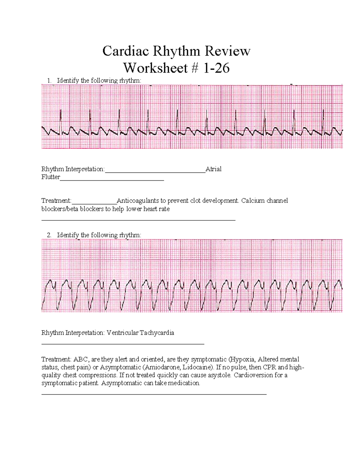 EKG Readings - ekg's - Cardiac Rhythm Review Worksheet # 1- Identify ...