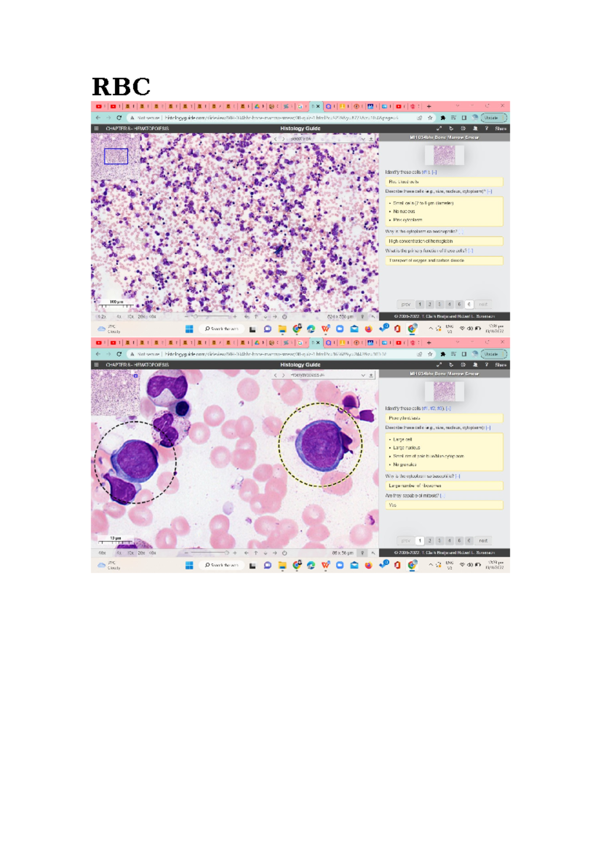 RBC mcqs - MCQ about RBC and hematology - RBC 6 to 8 μm 10 to 16 μm 20 ...