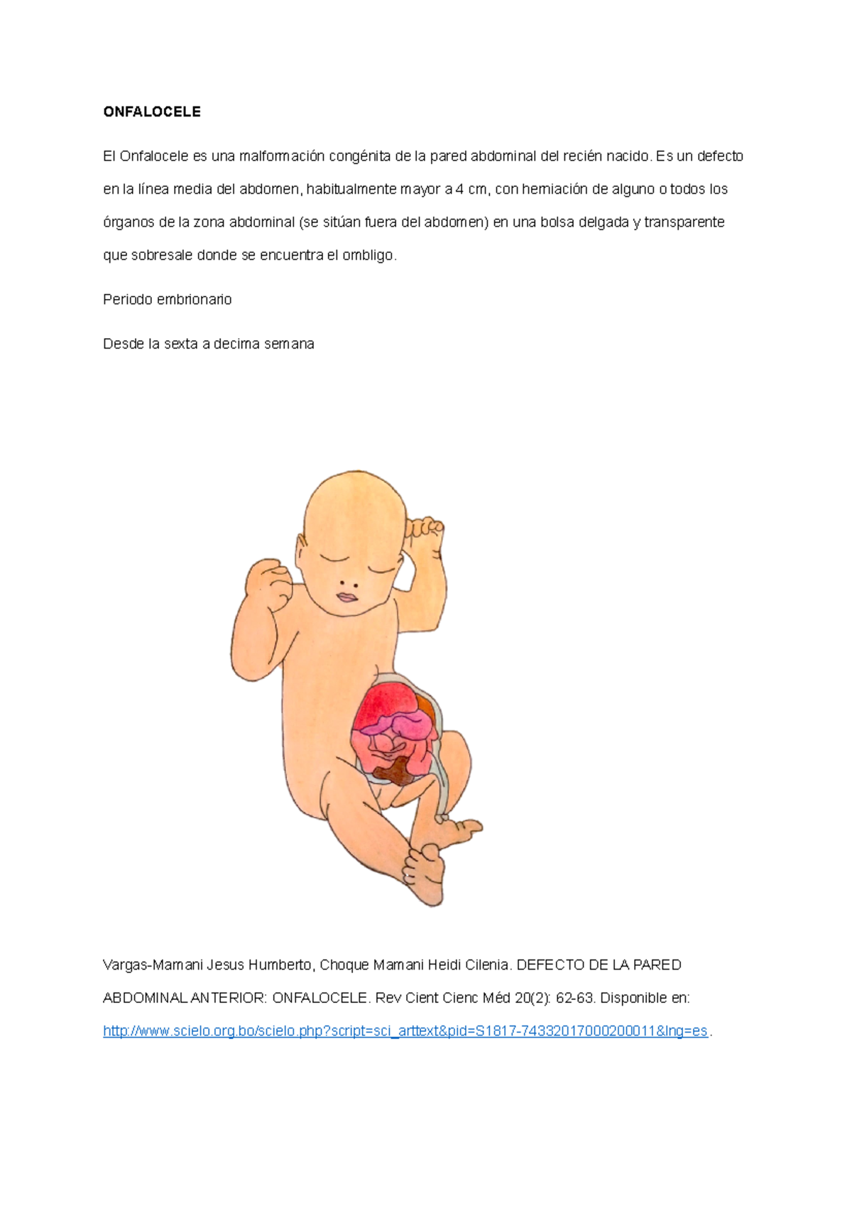 MALFORMACION EN EL FETO: Onfalocele - ONFALOCELE El Onfalocele es una ...