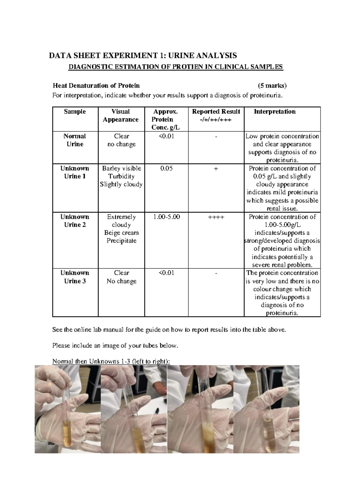 91193 Urine Analysis Data Sheet V2023 - POPH8310 - ANU - Studocu