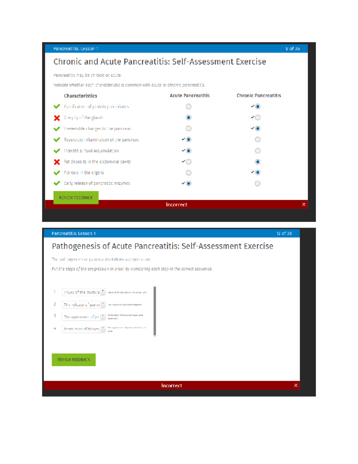 Course Point - Pancreatitis - Pancreatitis: Lesson 1 9 of 36 Chronic ...