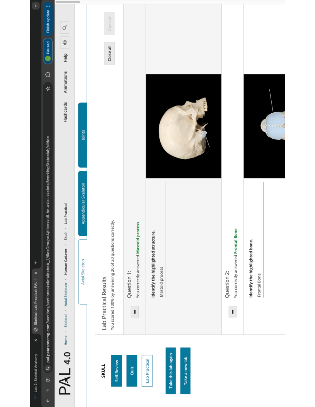 A&P 1 - Homework - Lab 2: Skeletal Anatomy Skeletal: Lab Practical: PAL ...