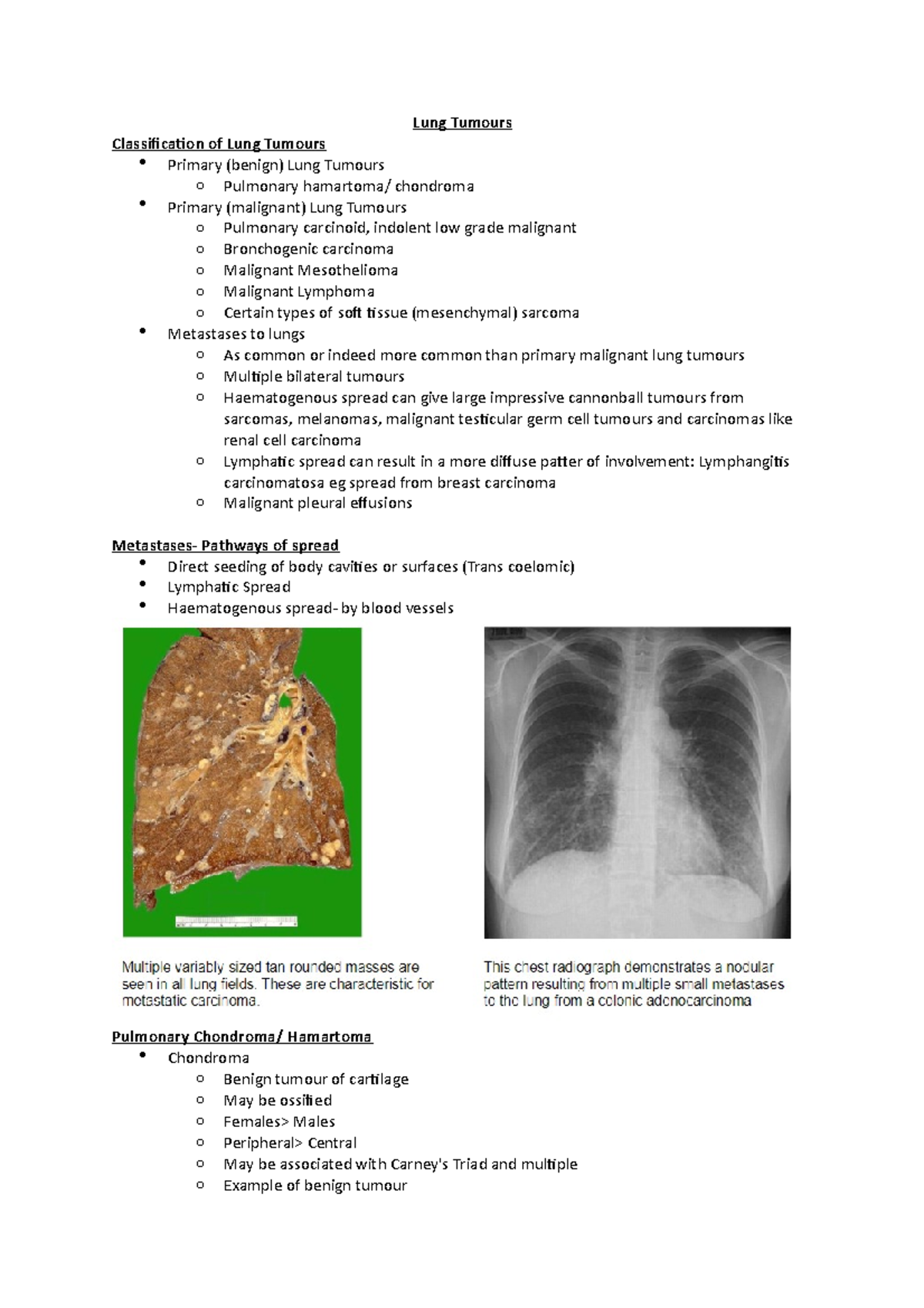 Lung Tumours - Lecture notes 57 - Lung Tumours Classification of Lung ...