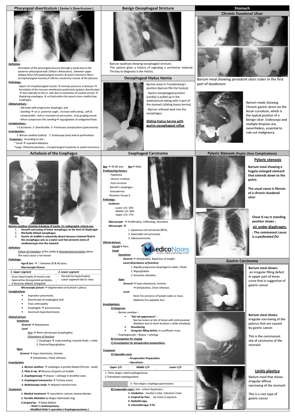 X-rays OSCE for surgerical diseases - Pharyngeal diverticulum ...