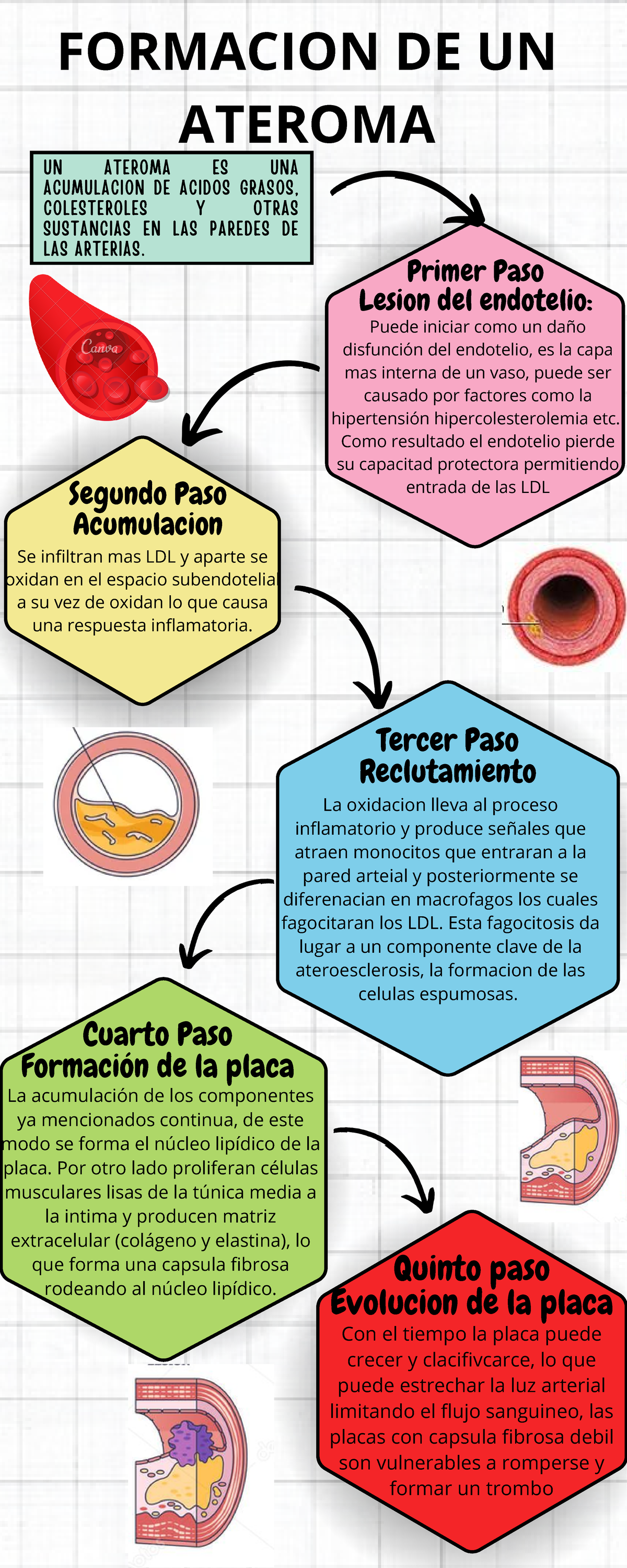 Formación de un ateroma - FORMACION DE UN ATEROMA La acumulación de los ...