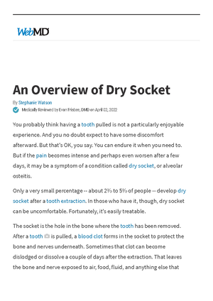 Lingual Nerve Block (selective anesthesia for tongue and floor of mouth ...