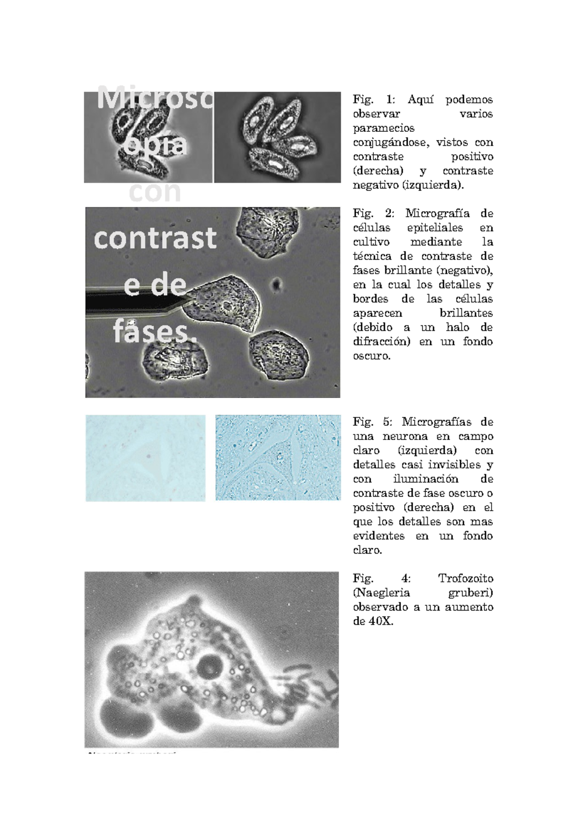 Microscopia de contraste de fases - Fig. 1: Aquí podemos observar ...