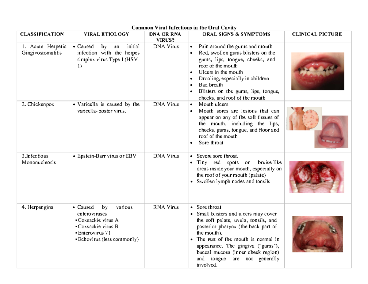 Viral Infections ON Mouth - Advanced Microbiology - Studocu