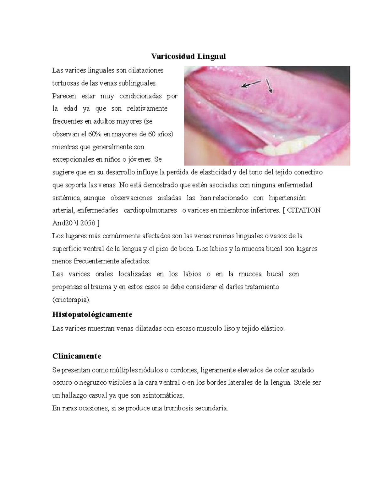 Resumen acerca de las Várices linguales - Varicosidad Lingual Las ...