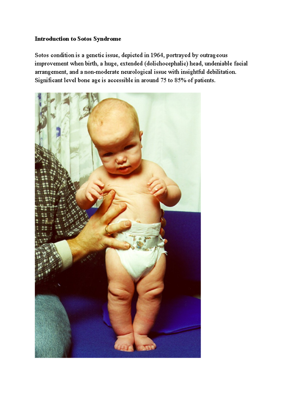 Sotos Syndrome - Signs and Symptoms - Introduction to Sotos Syndrome ...