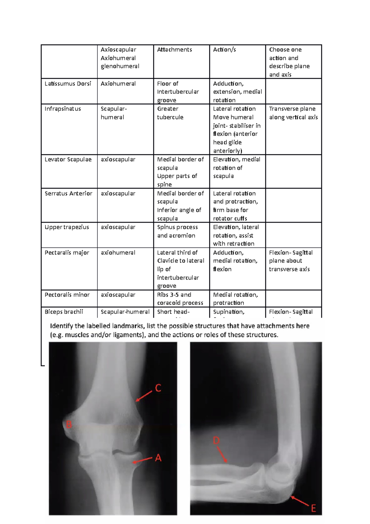 Zoom week 8 tues - tutorial notes - Axioscapular Axiohumeral ...