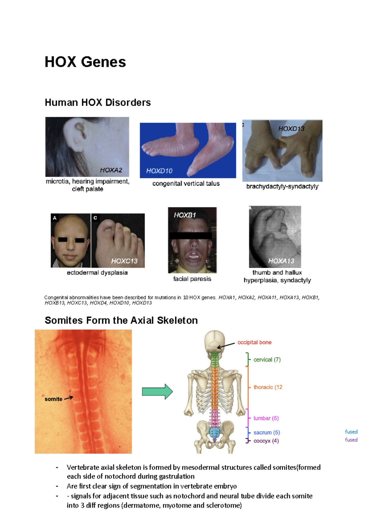 HOX Genes - HOX Genes Human HOX Disorders Congenital abnormalities have ...
