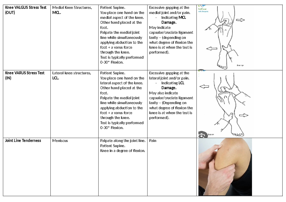 Knee - Special Test - Knee VALGUS Stress Test (OUT) Medial Knee ...