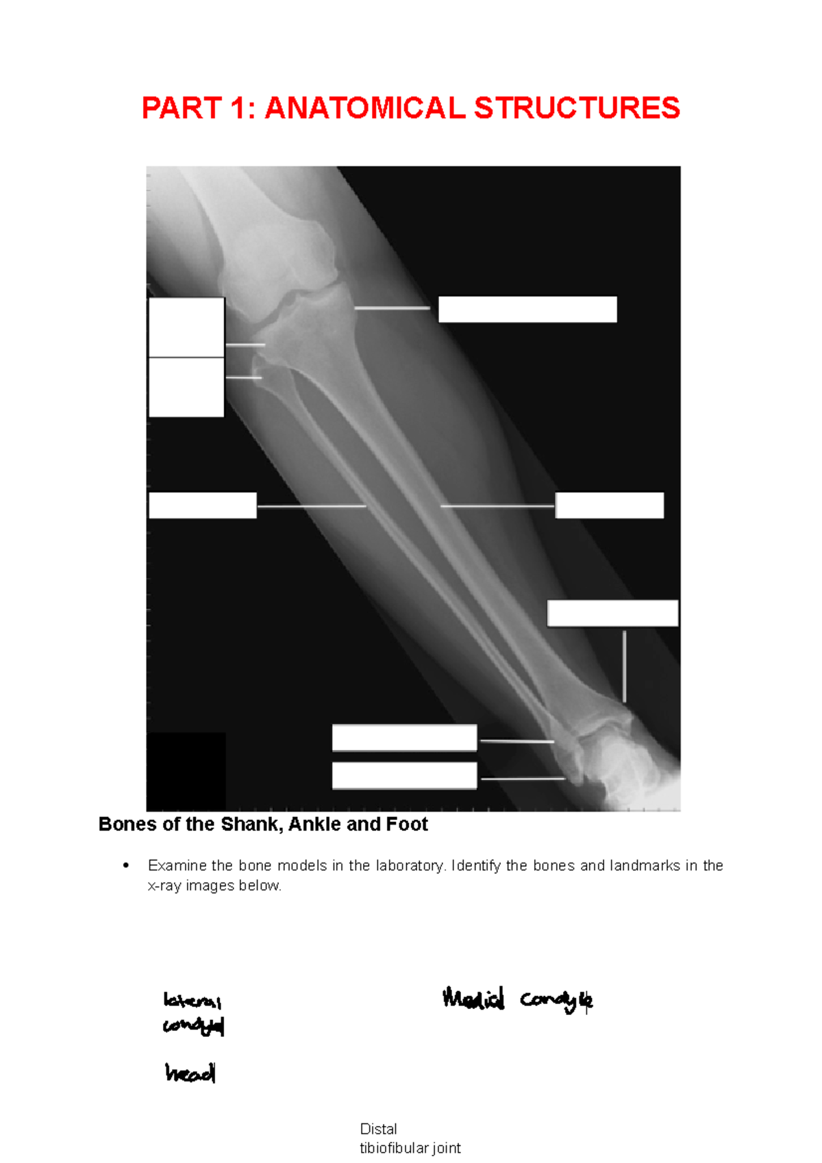 Activity 3 - Shank, Ankle and Foot - PART 1: ANATOMICAL STRUCTURES ...