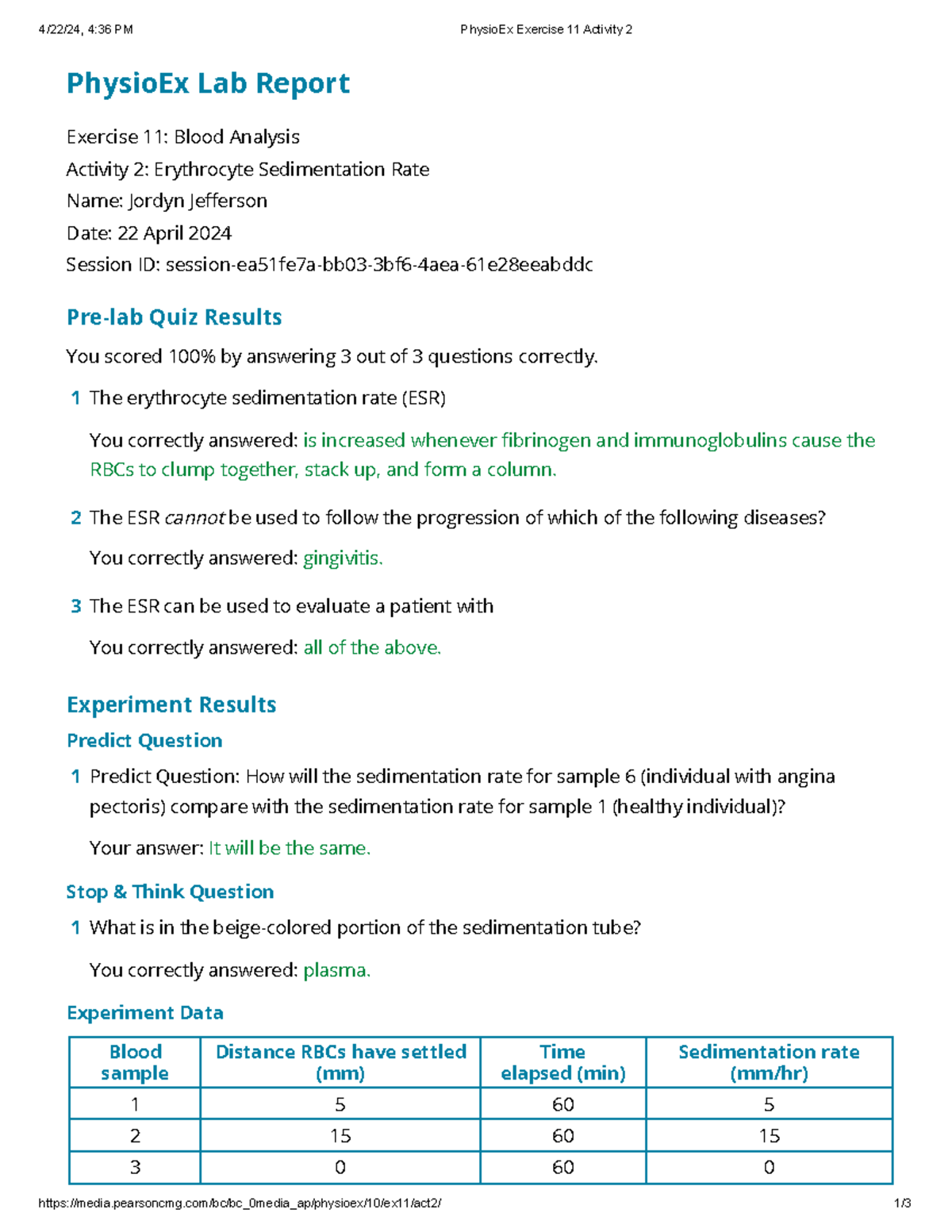 Physio Ex Exercise 11 Activity 2 Jordyn Jefferson 4 22 24 4 36 Pm