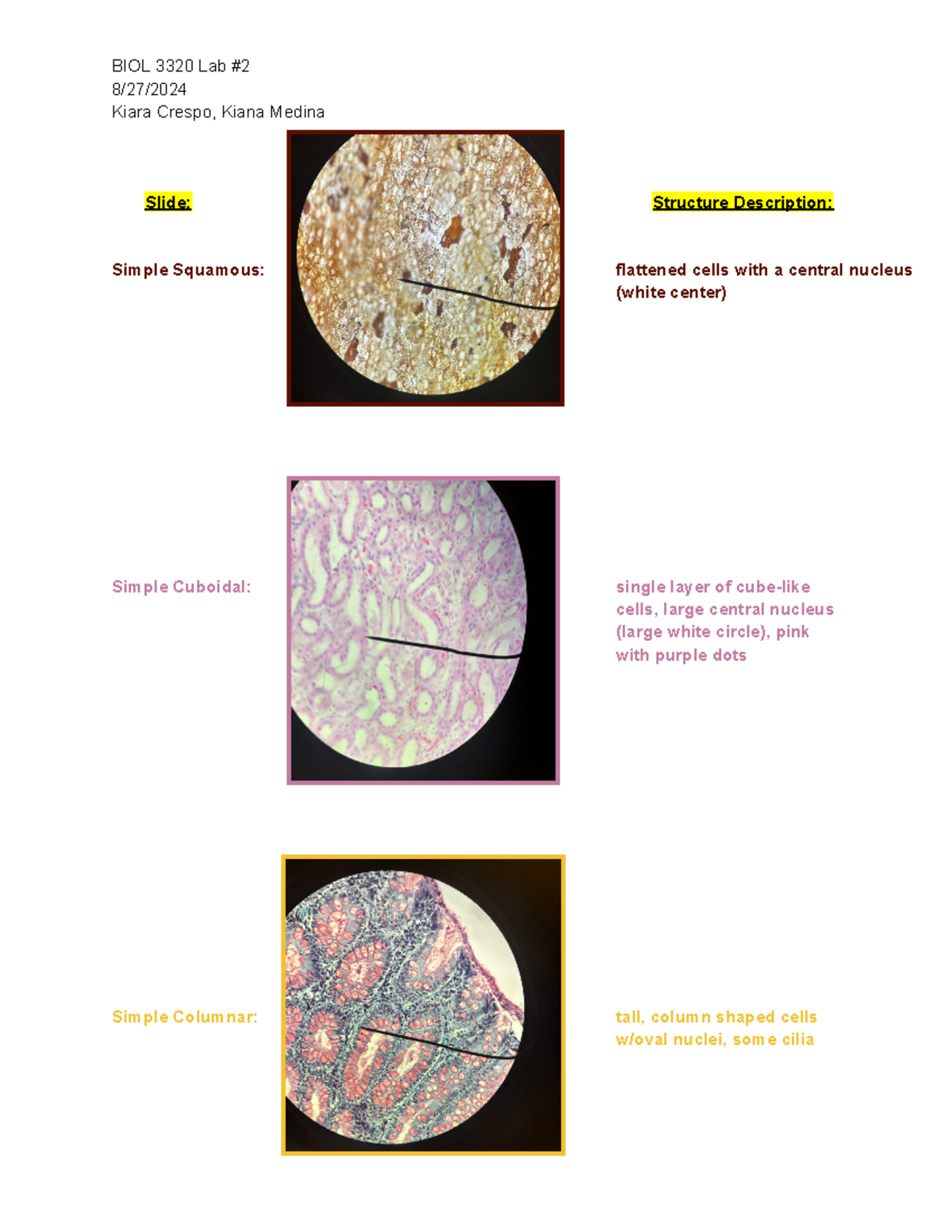 Epithelium Tissue Lab #2 - BIOL 3320 Lab # 8/27/ Kiara Crespo, Kiana ...