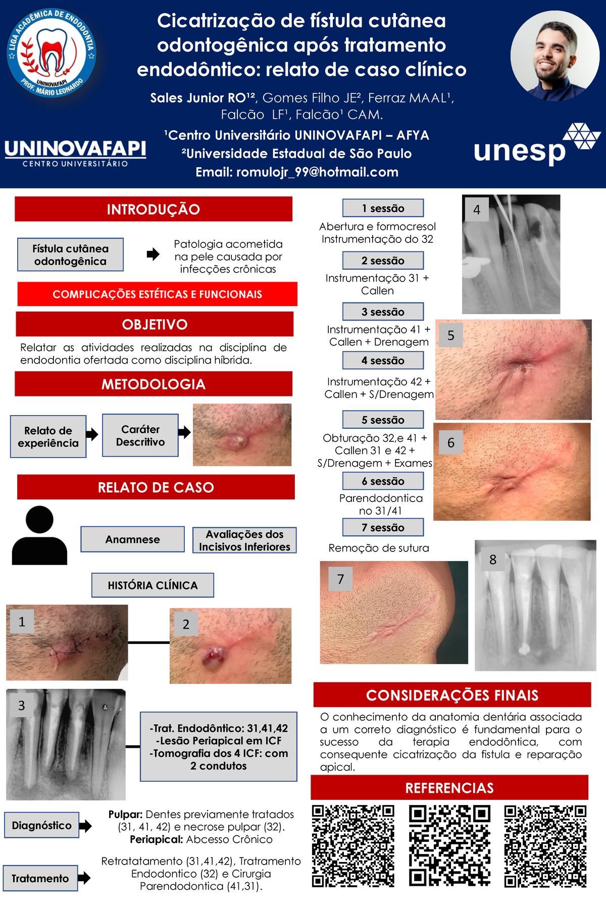 CASO Fistula - Odontologia - CicatrizaÁ„o de fÌstula cut‚nea ...
