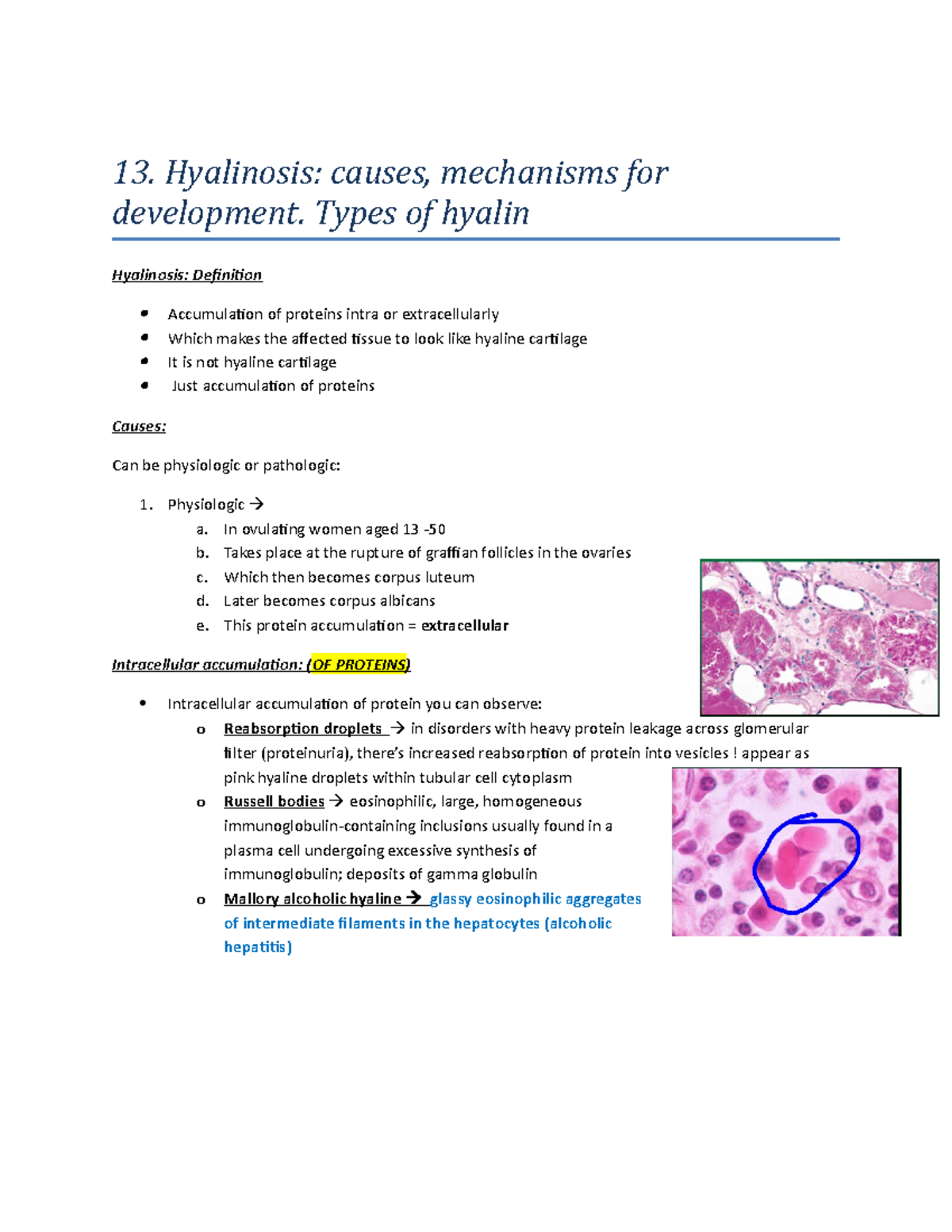13. Hyalinosis - 13. Hyalinosis: causes, mechanisms for development ...