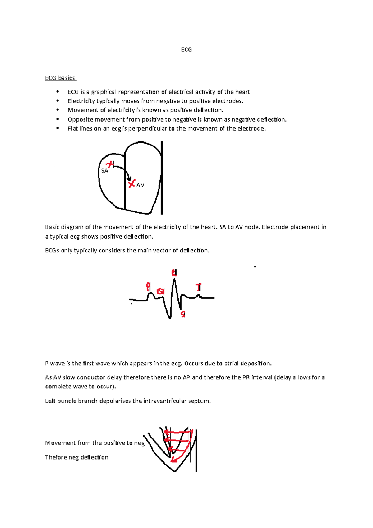 Ecgs - summary of said topic - ECG ECG basics ECG is a graphical ...