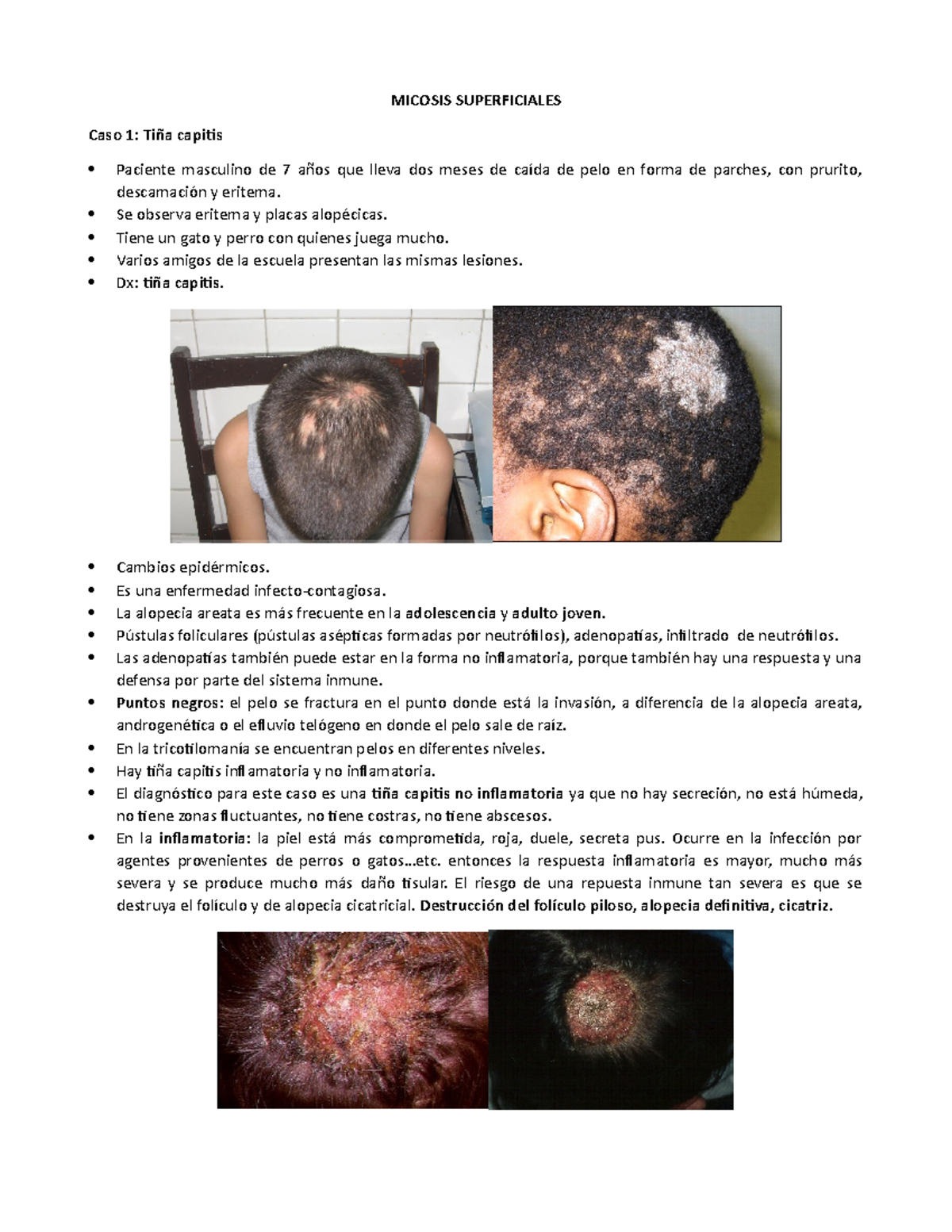16. Micosis superficiales - MICOSIS SUPERFICIALES Caso 1: Tiña capitis ...