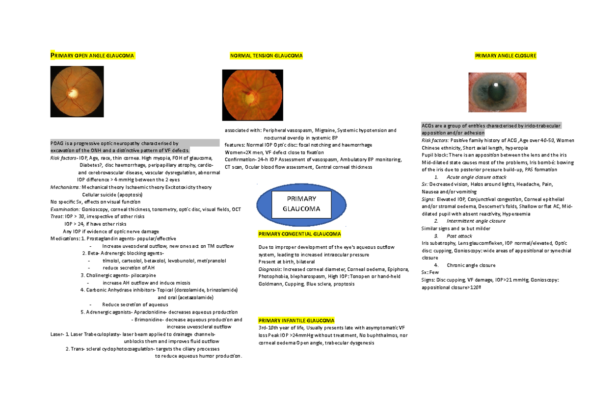 Glaucoma Mindmap - PRIMARY OPEN ANGLE GLAUCOMA NORMAL TENSION GLAUCOMA PRIMARY ANGLE CLOSURE ...