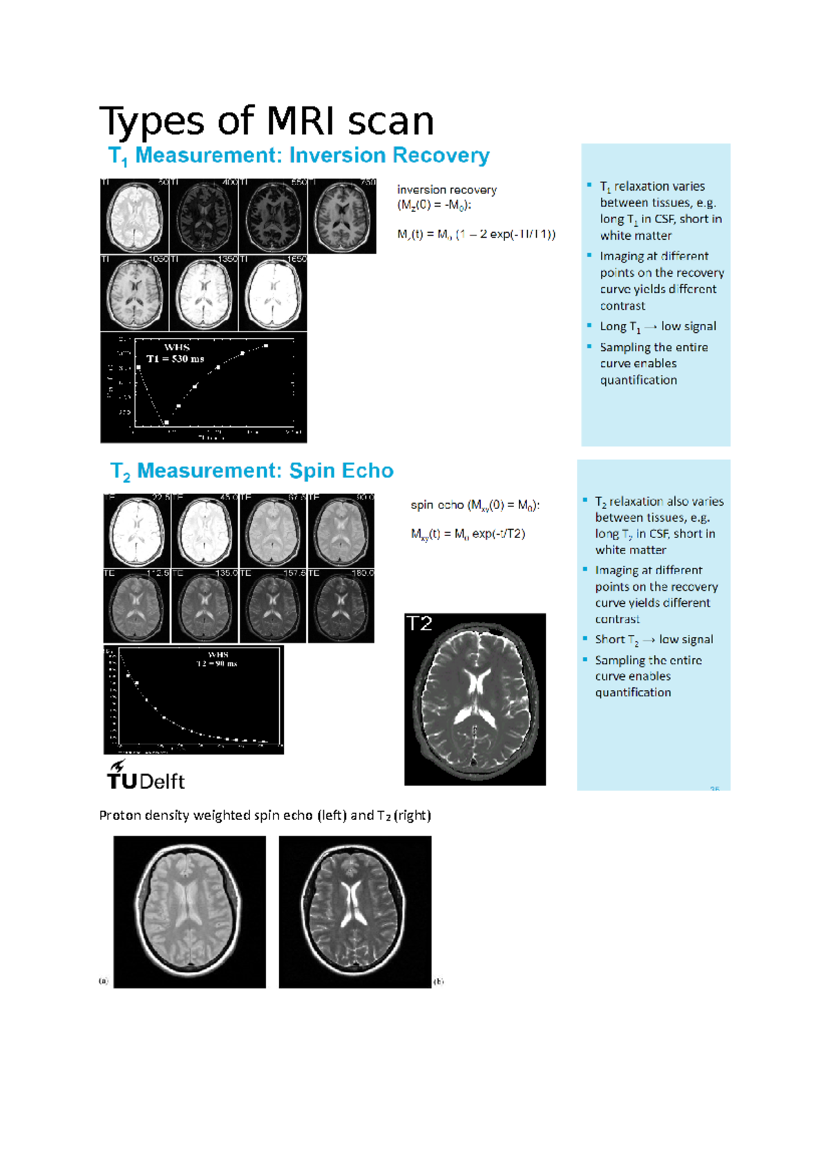 Types of MRI scan - Types of MRI scan Proton density weighted spin echo ...