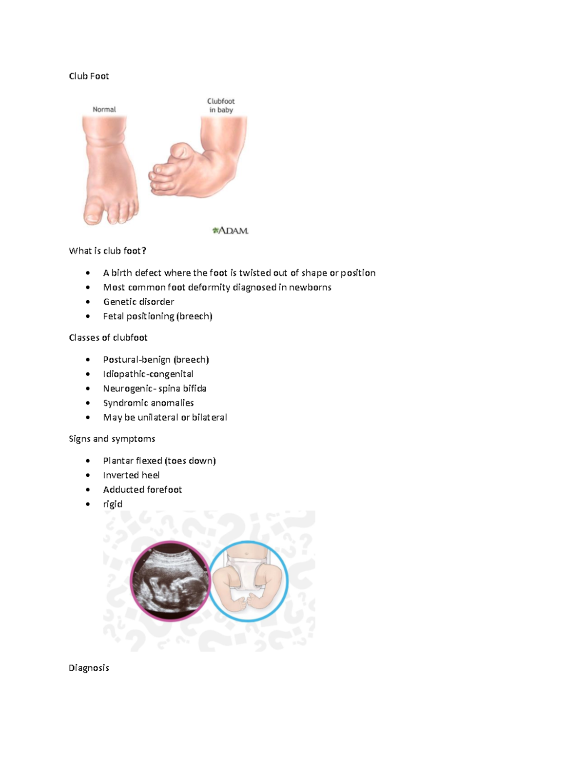 Club foot - Lecture notes for club foot - Club Foot What is club foot ...