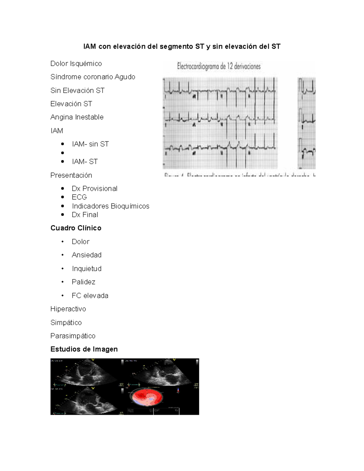 IAM con elevación del segmento ST y sin elevación del ST - IAM con ...