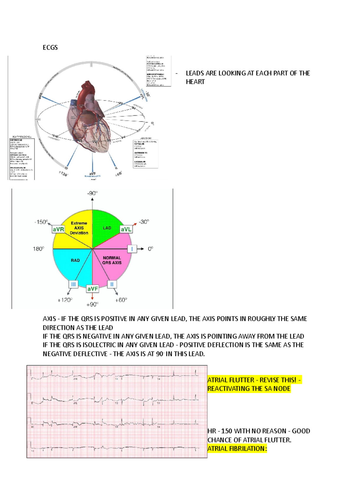 ECGS - ECGS - LEADS ARE LOOKING AT EACH PART OF THE HEART AXIS - IF THE ...