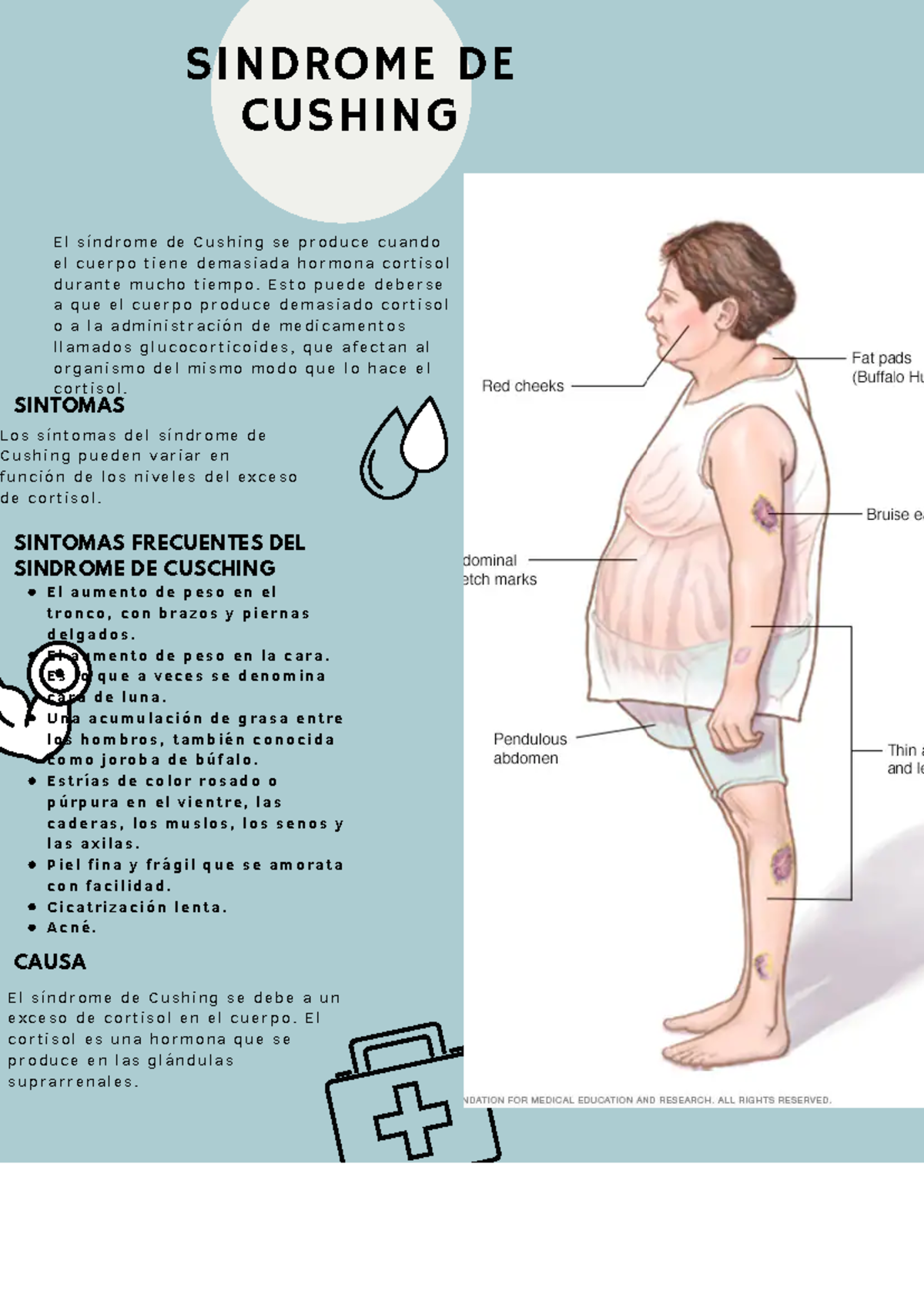 Sindrome de cushing - tarea de orga - SINDROME DE CUSHING E l s í n d r ...