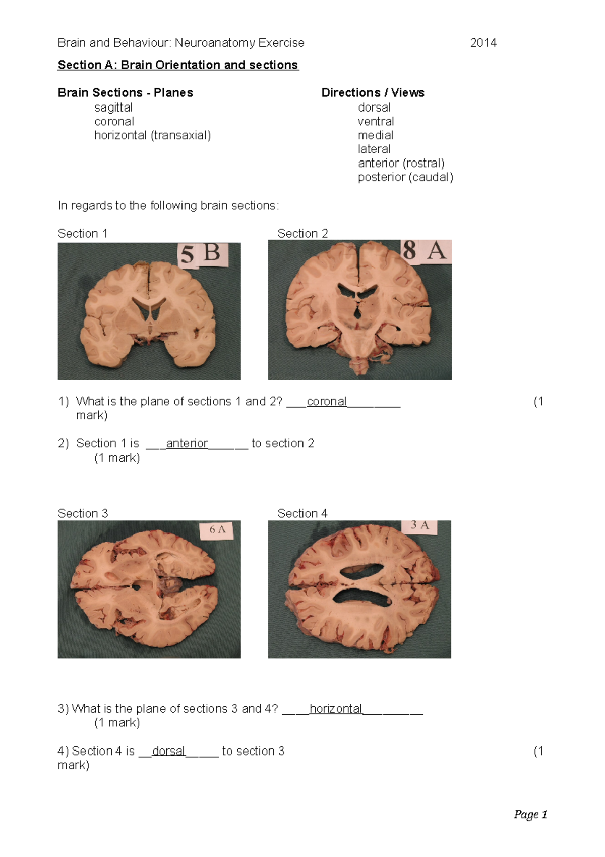 Neuroanatomy Exercise-2014 backup - Brain and Behaviour: Neuroanatomy ...