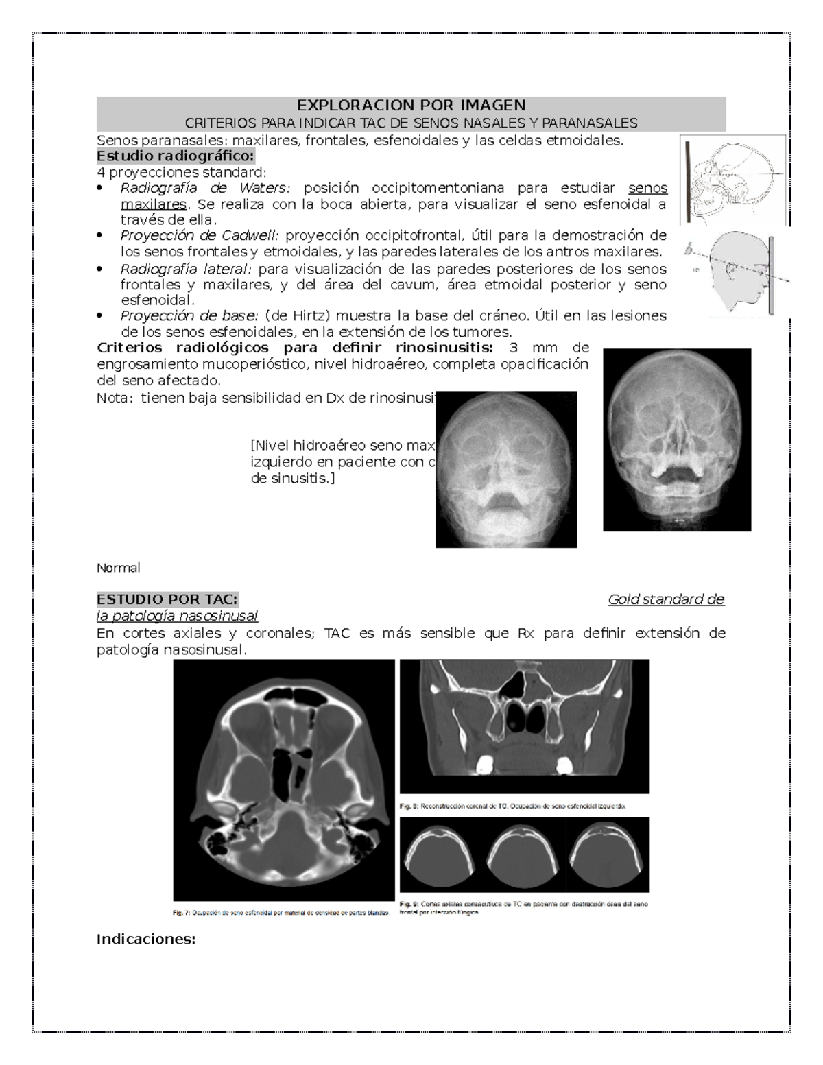 TAC Rinitis-YA - Resumen Diagnóstico por imagen - EXPLORACION POR ...
