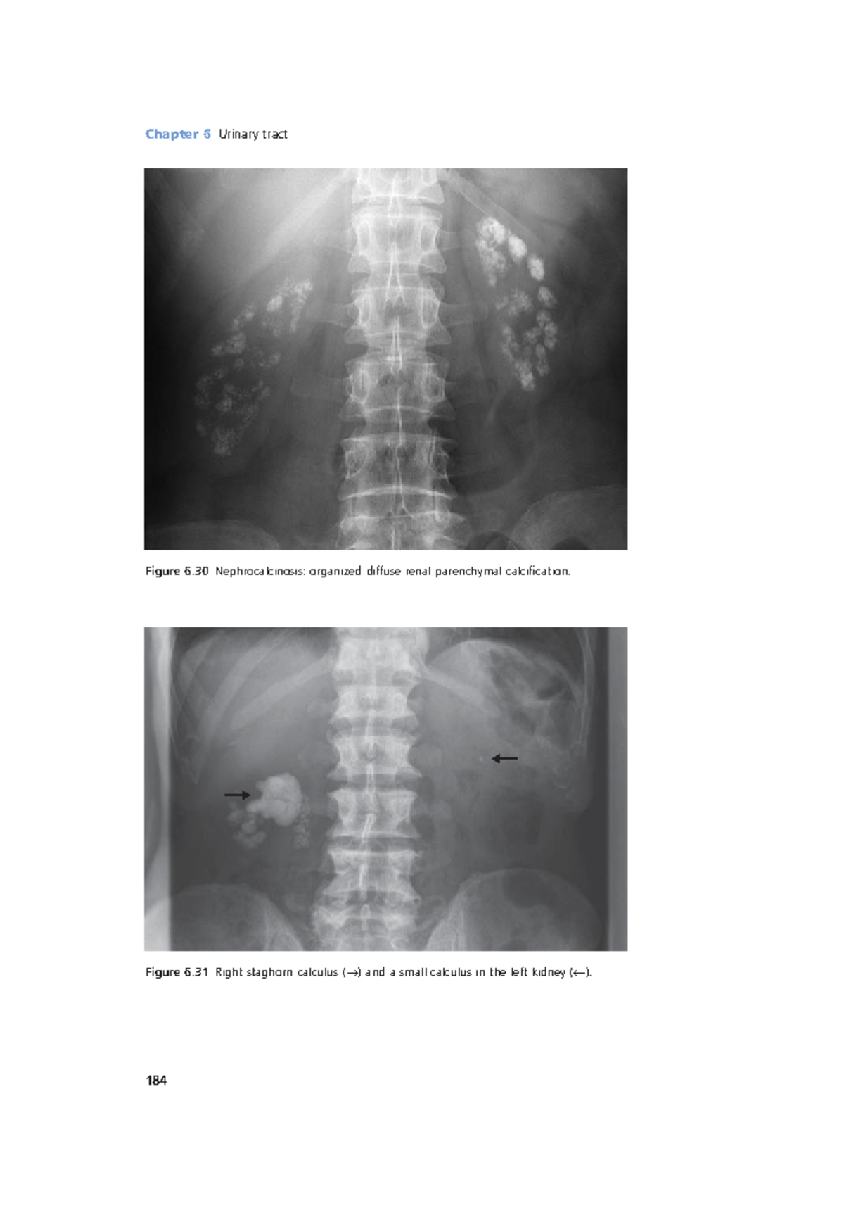 Radiology Lecture Notes pdf (62) - Chapter 6 Urinary tract 184 Figure 6 ...