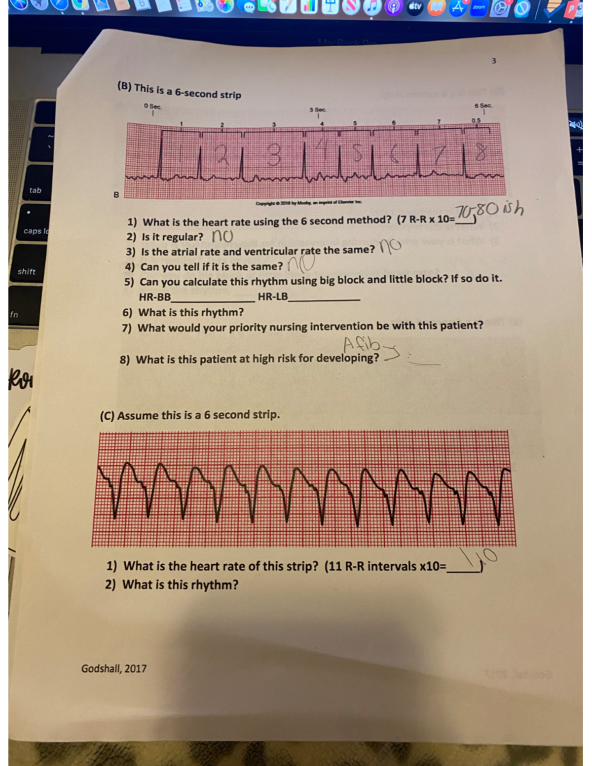 EKG packet 3 - NURS 420 - Studocu