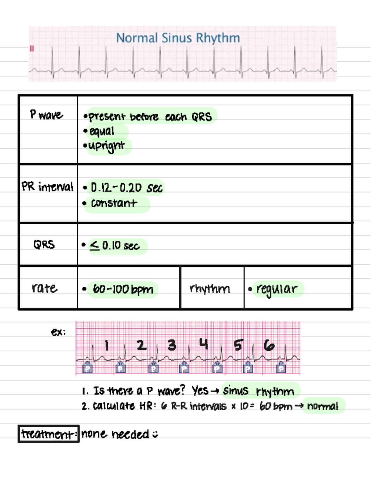 Sinus Rhythms - Hand notes - NUR 1930 - Studocu