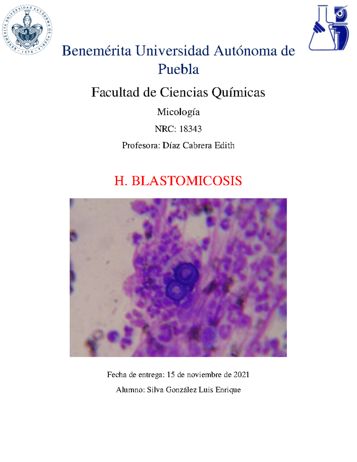 H. Blastomicosis - Blastoplasmosis - Benemérita Universidad Autónoma de Puebla Facultad de ...