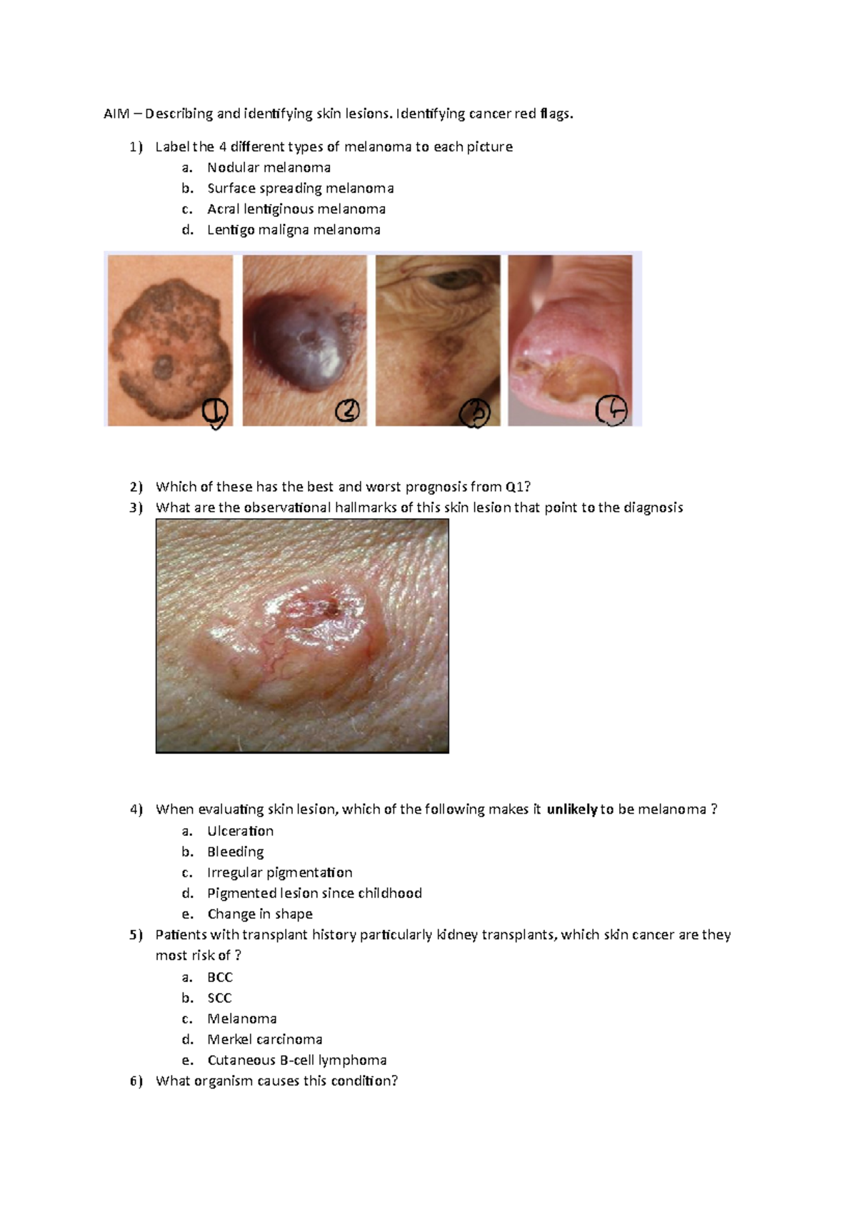 Derm revision - Dermatology lecture mcq questions - skin lesion picture ...
