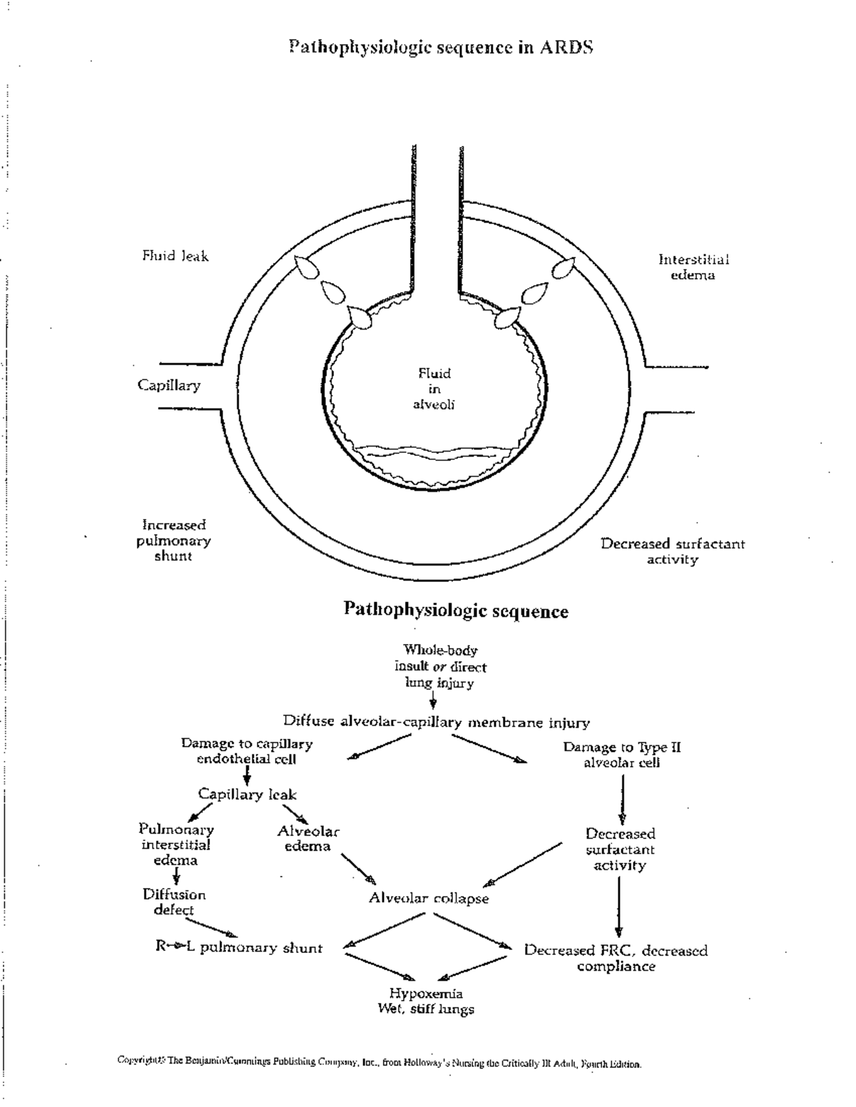 Pathophysiologic sequence in ARDS.doc - Pathophysiologic sequence in ...