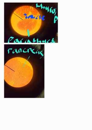 Endocrine Organs on the Torso Model - BIOL-2401 - Torso – Endocrine ...