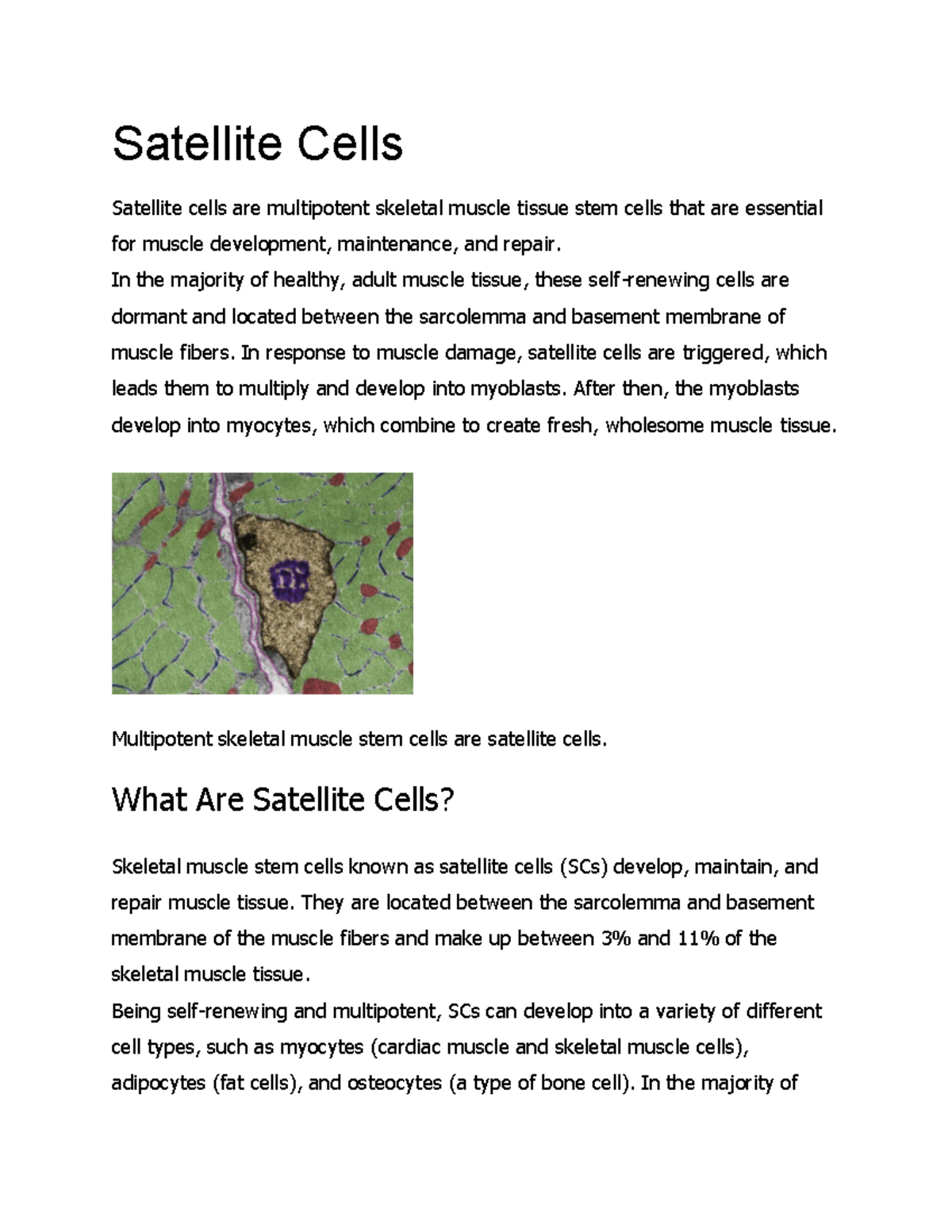 Satellite Cells - Satellite Cells Satellite cells are multipotent ...