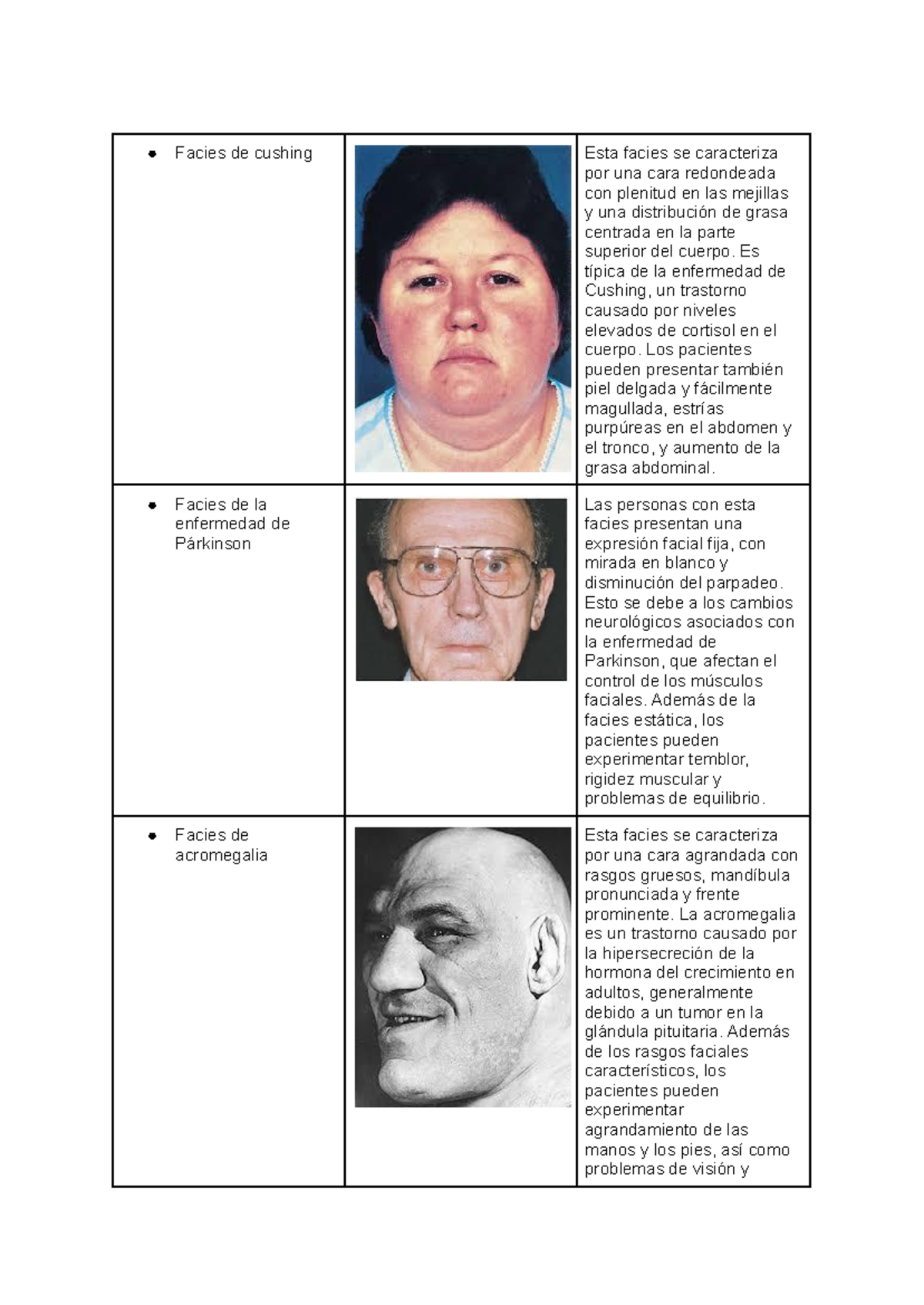 Tabla - Facies de cushing Esta facies se caracteriza por una cara ...