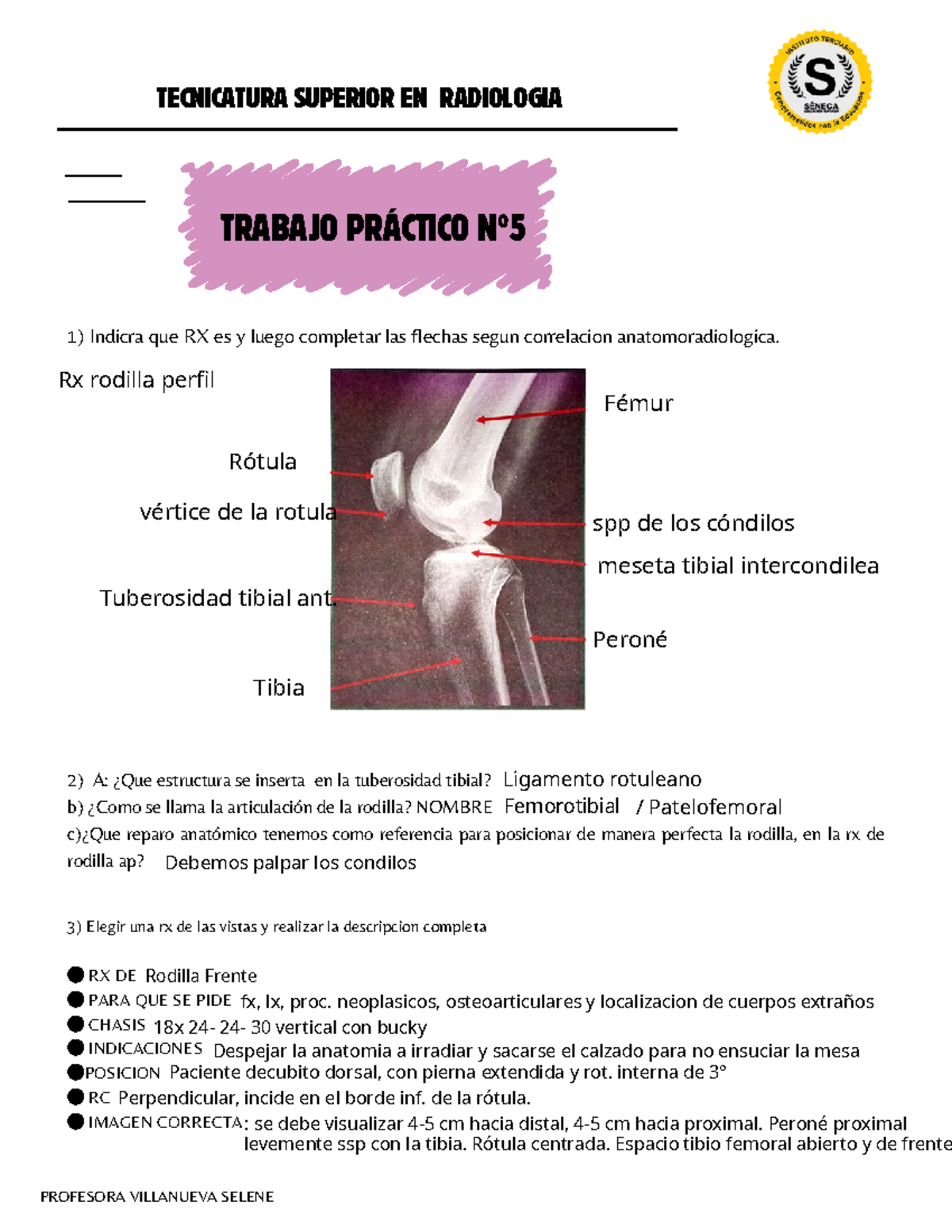 TP n° 5- Comisión A - TRABAJO PRÁCTICO Nº 1) Indicra que RX es y luego ...