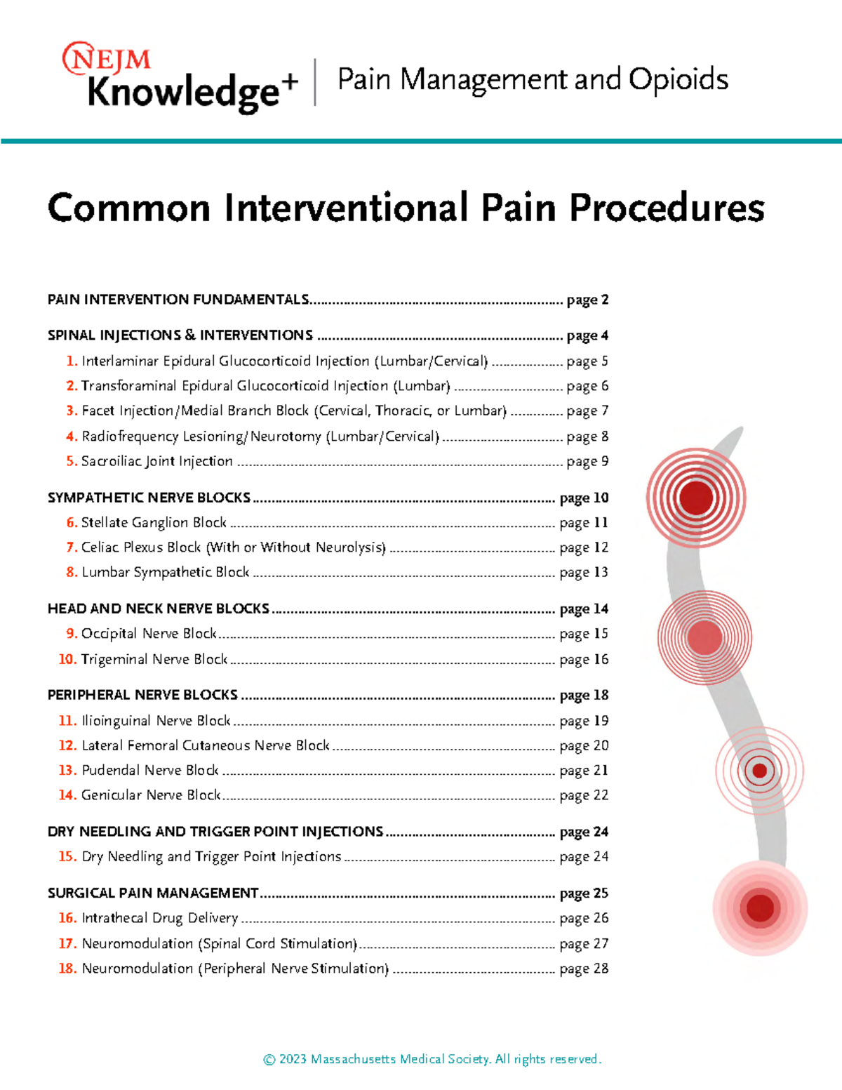 Common interventional pain procedures - Common Interventional Pain ...