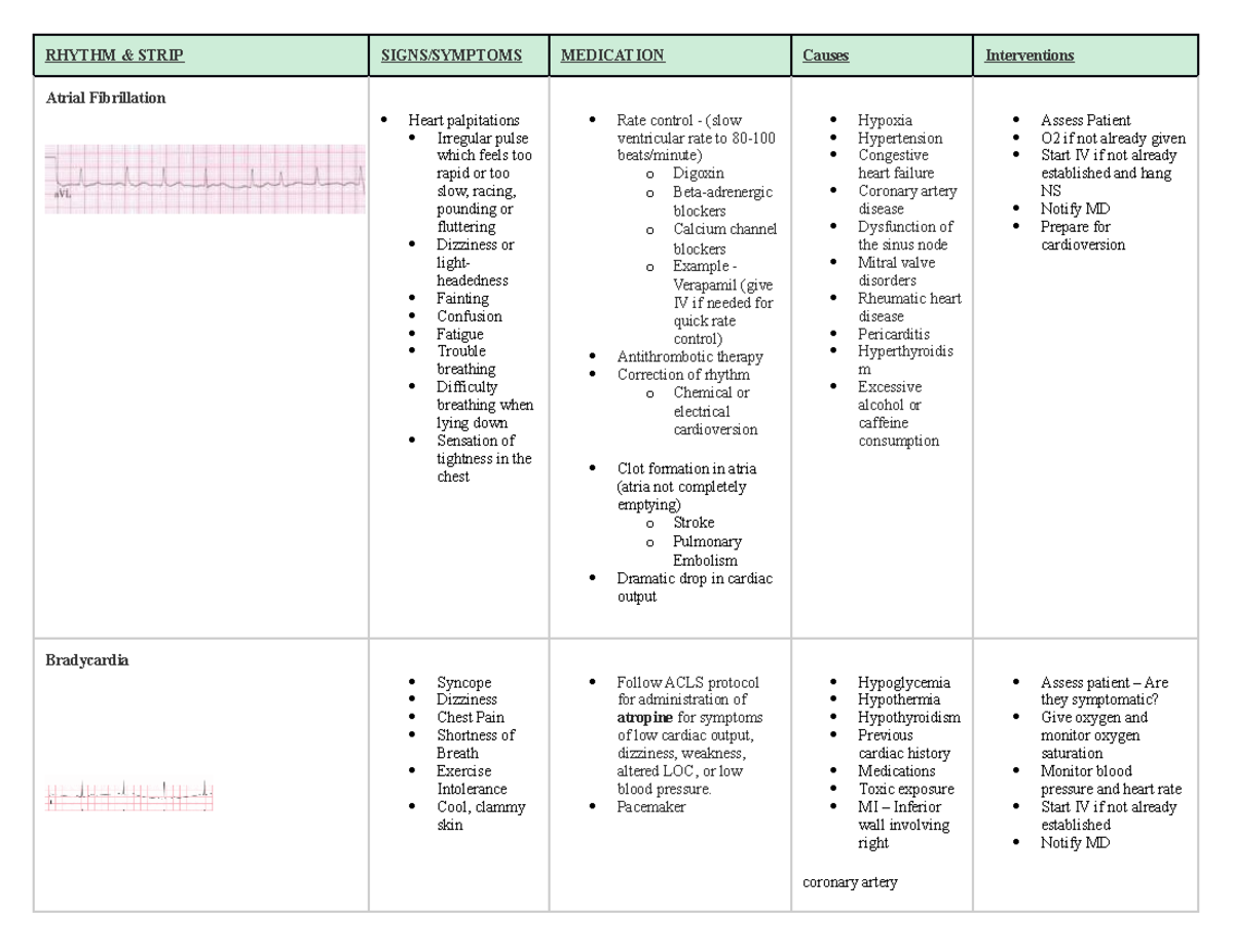 EKG - Atrial Fibrillation Heart palpitations Irregular pulse which ...