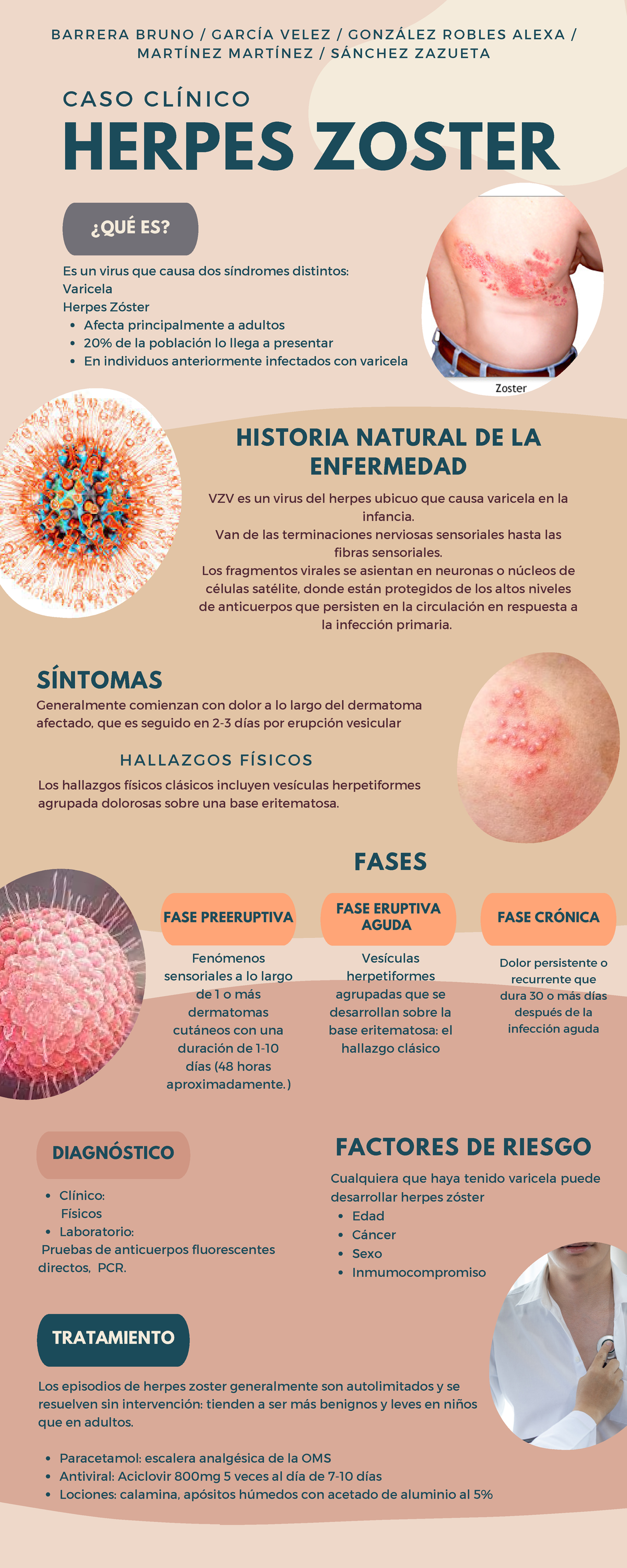 Herpes Zoster y características - DIAGNÓSTICO TRATAMIENTO ¿QUÉ ES? Afecta principalmente a ...