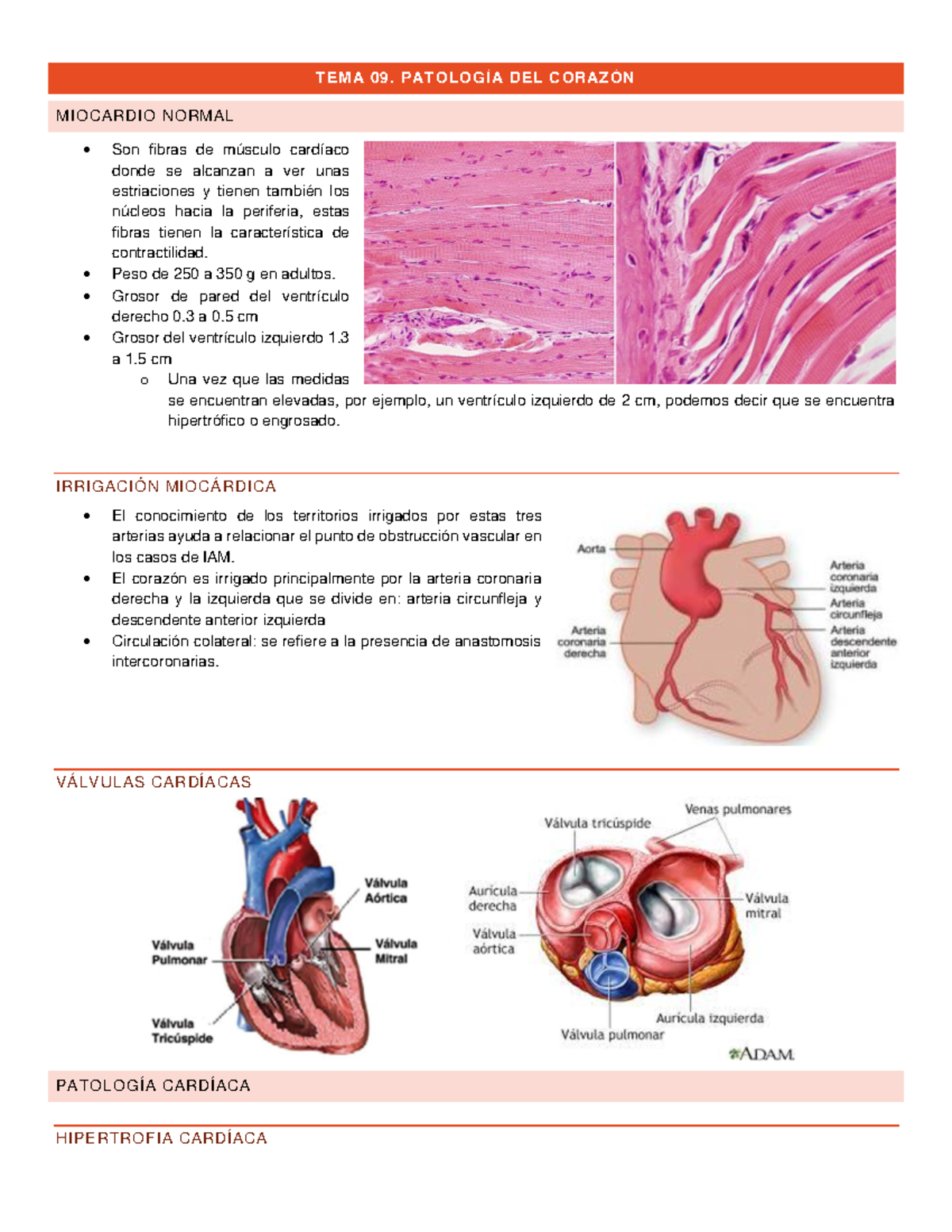 TEMA 09. Patología del corazón - T EMA 09. PAT OL OGÍA DEL CORAZÓN M ...