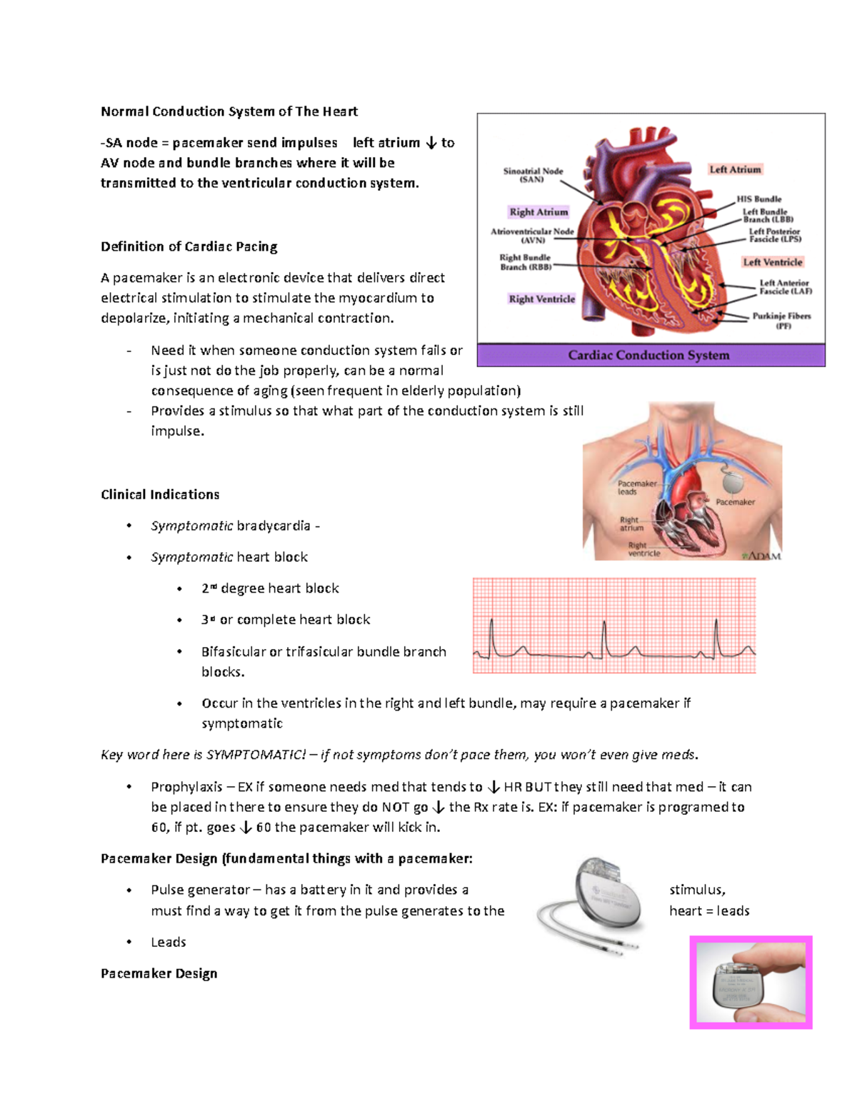 Cardiac Pacing - Normal Conduction System of The Heart -SA node ...