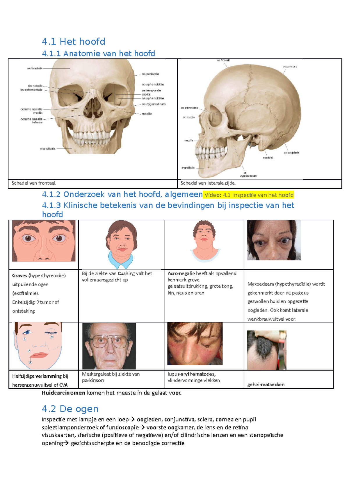 H 4 hoofd hals samenvatting - 4 Het hoofd 4.1 Anatomie van het hoofd ...