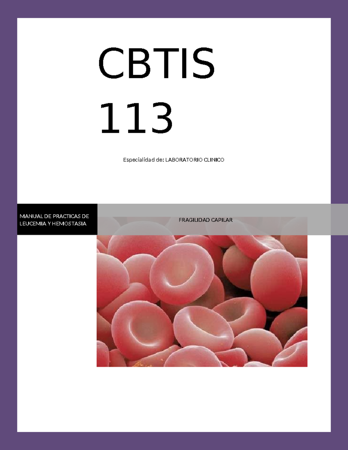 Fragilidad capilar - Practica - CBTIS 113 Especialidad de: LABORATORIO ...