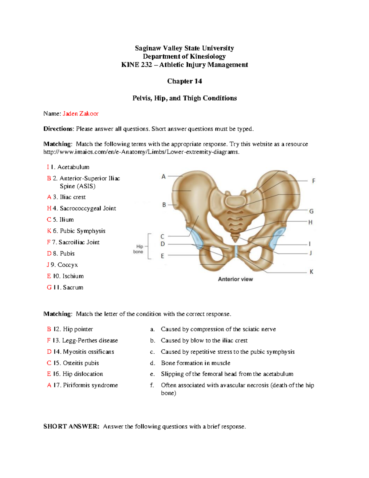 Chapter 14 - Pelvis Conditions - Saginaw Valley State University ...